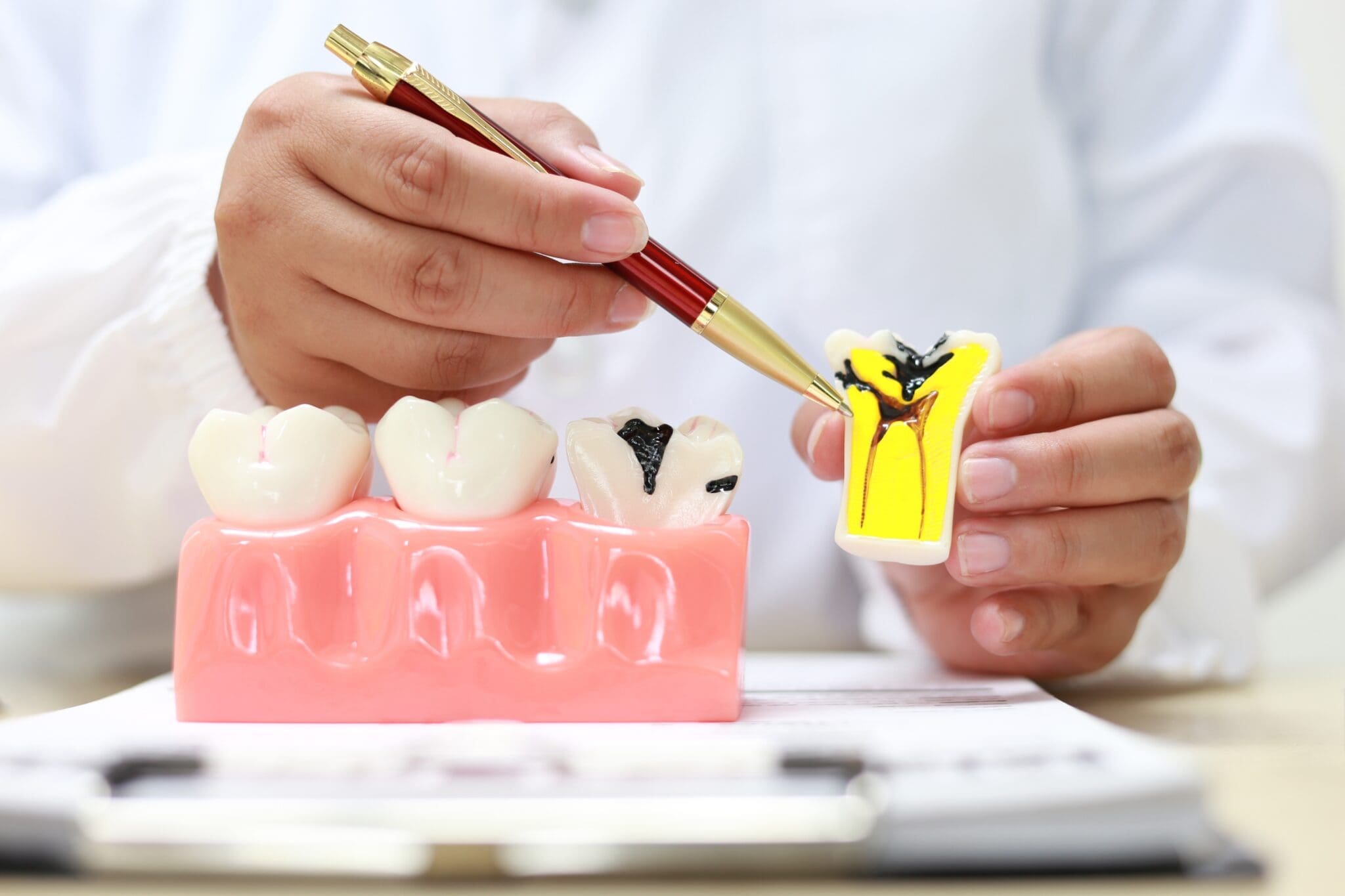 Root Canal Aftercare: Recovery Tips and Diet | Clean Smiles Dental Clinic